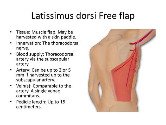 Latissimus dorsi free flap