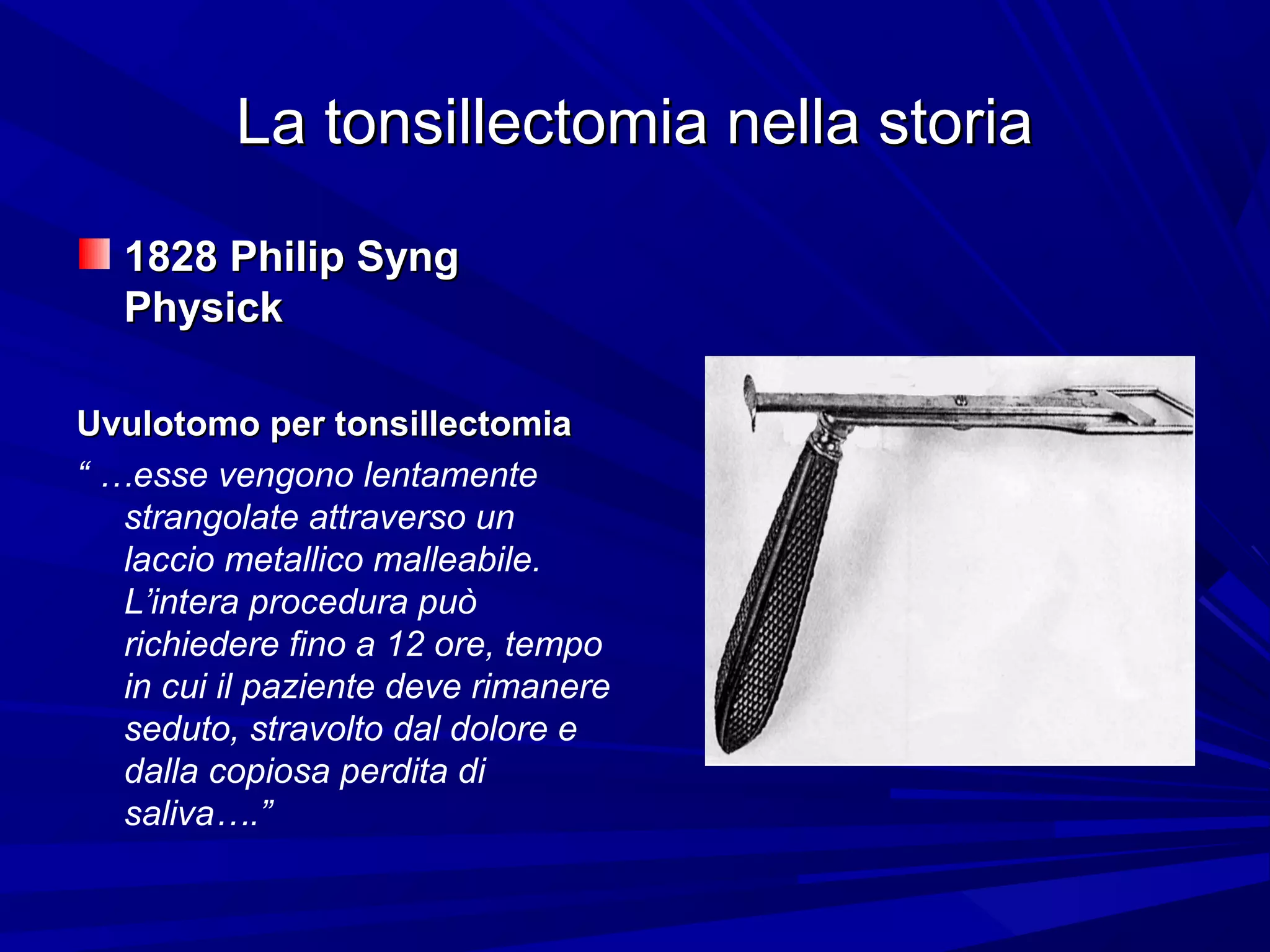 La tonsillectomia | PPT