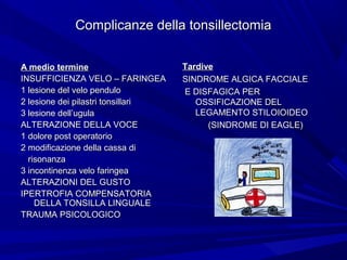 La tonsillectomia | PPT