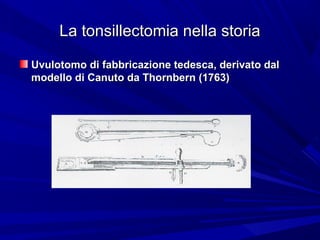 La tonsillectomia | PPT