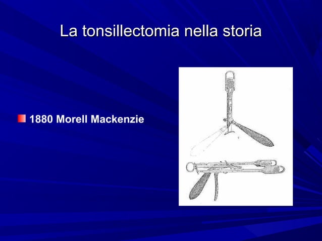 La tonsillectomia | PPT