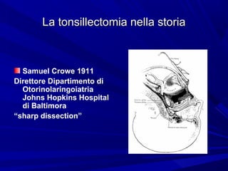 La tonsillectomia | PPT