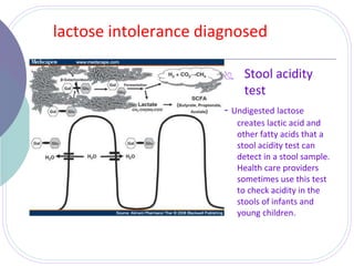Latose intilerance | PPTX