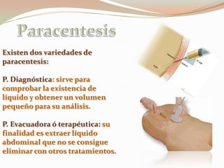 Lavado gastrico y paracentesis | PPTX