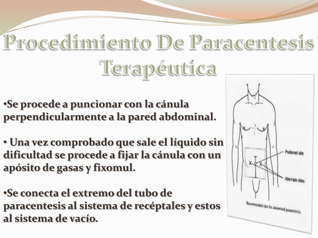 Lavado gastrico y paracentesis | PPT