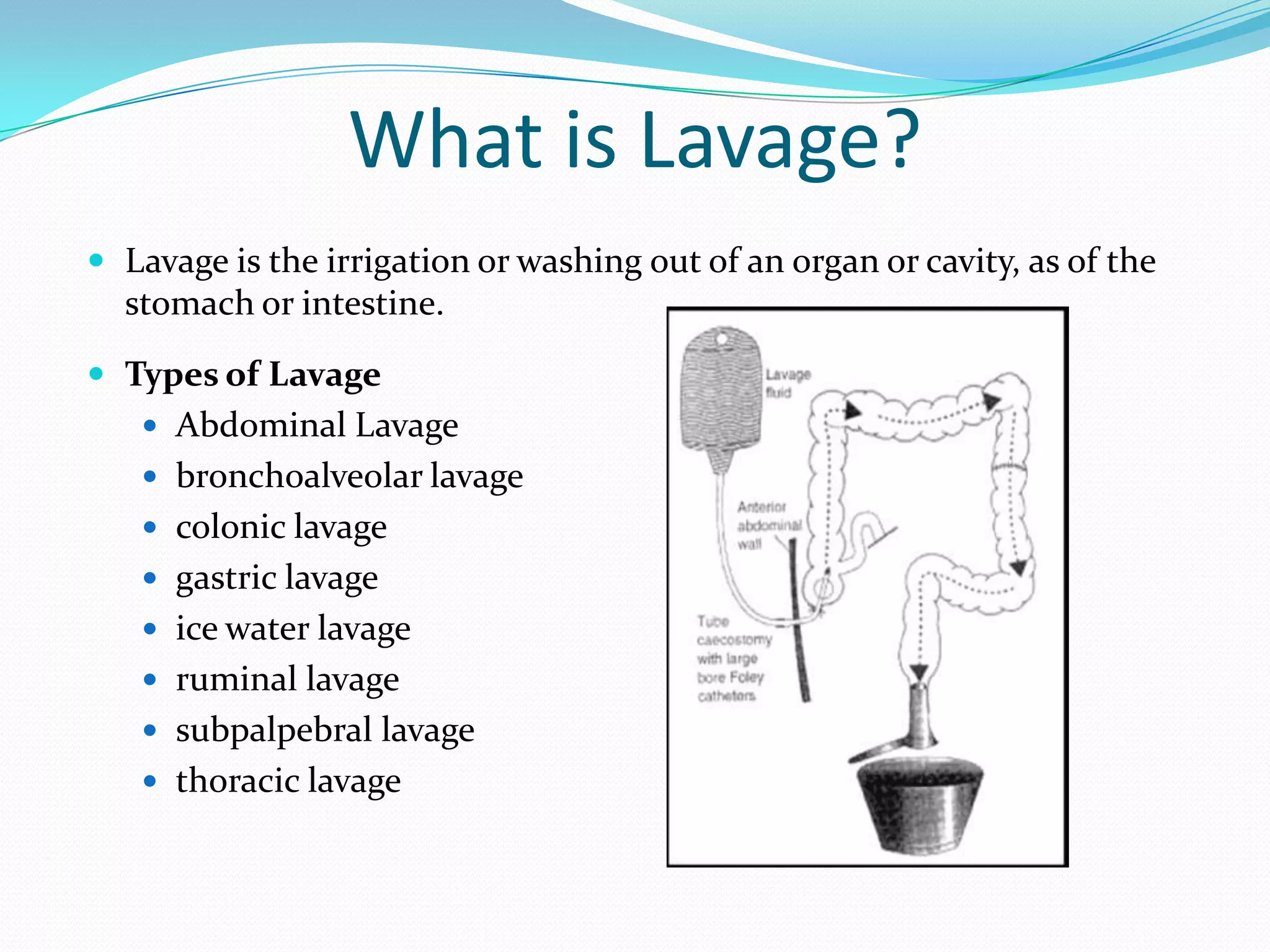Lavage, Hernioplasty, Extraction, And Anastomosis | PPTX