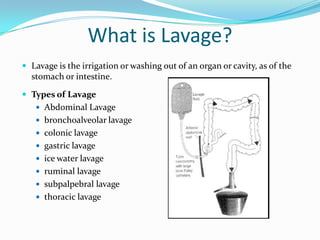 Lavage, Hernioplasty, Extraction, And Anastomosis | PPTX