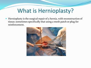 Lavage, Hernioplasty, Extraction, And Anastomosis | PPTX