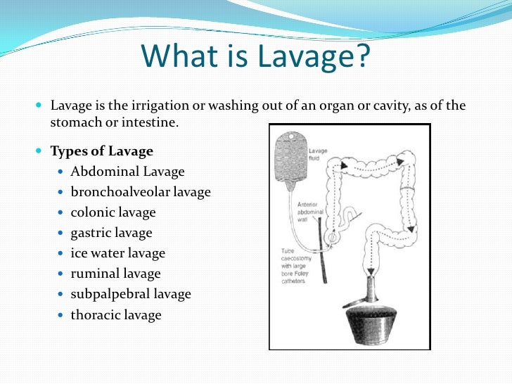 Lavage, Hernioplasty, Extraction, And Anastomosis