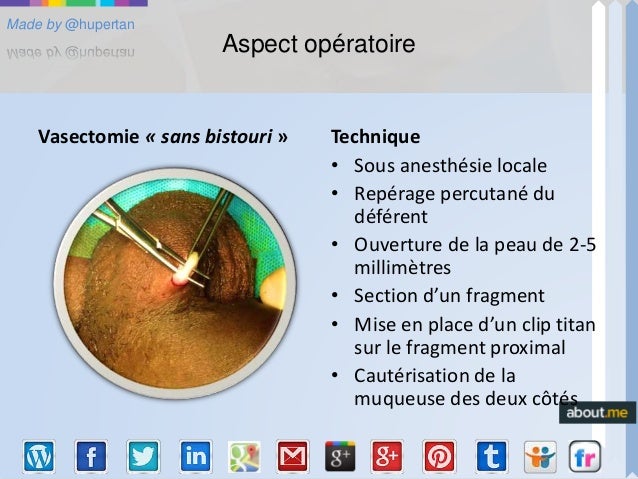 La vasectomie contraceptive expliquée aux patients