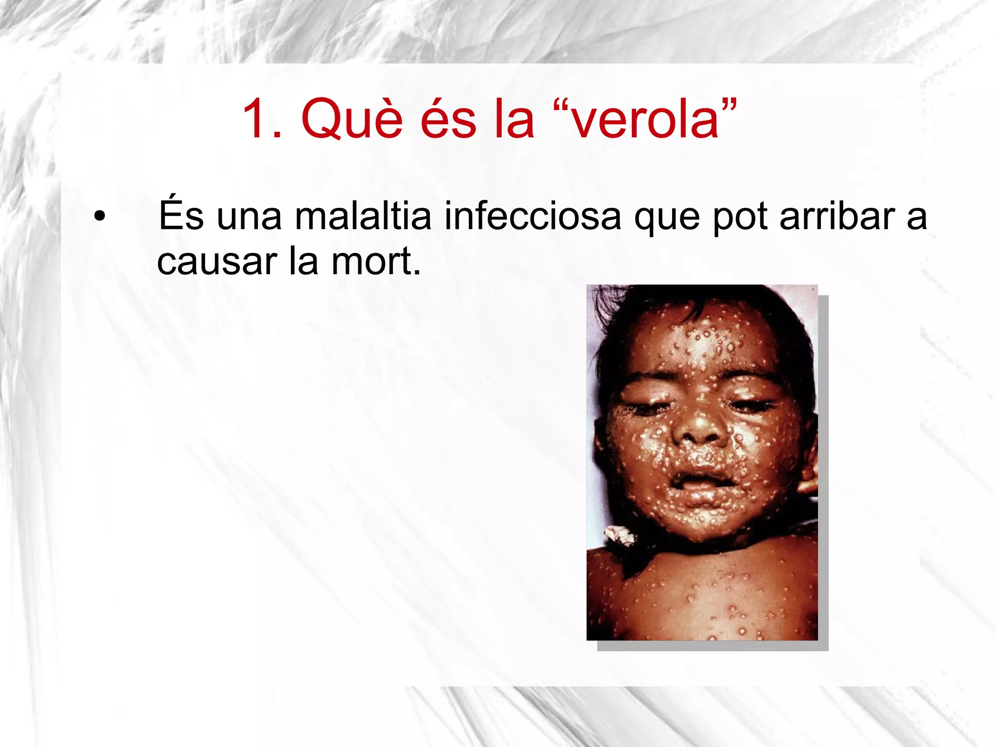 La verola | PPT