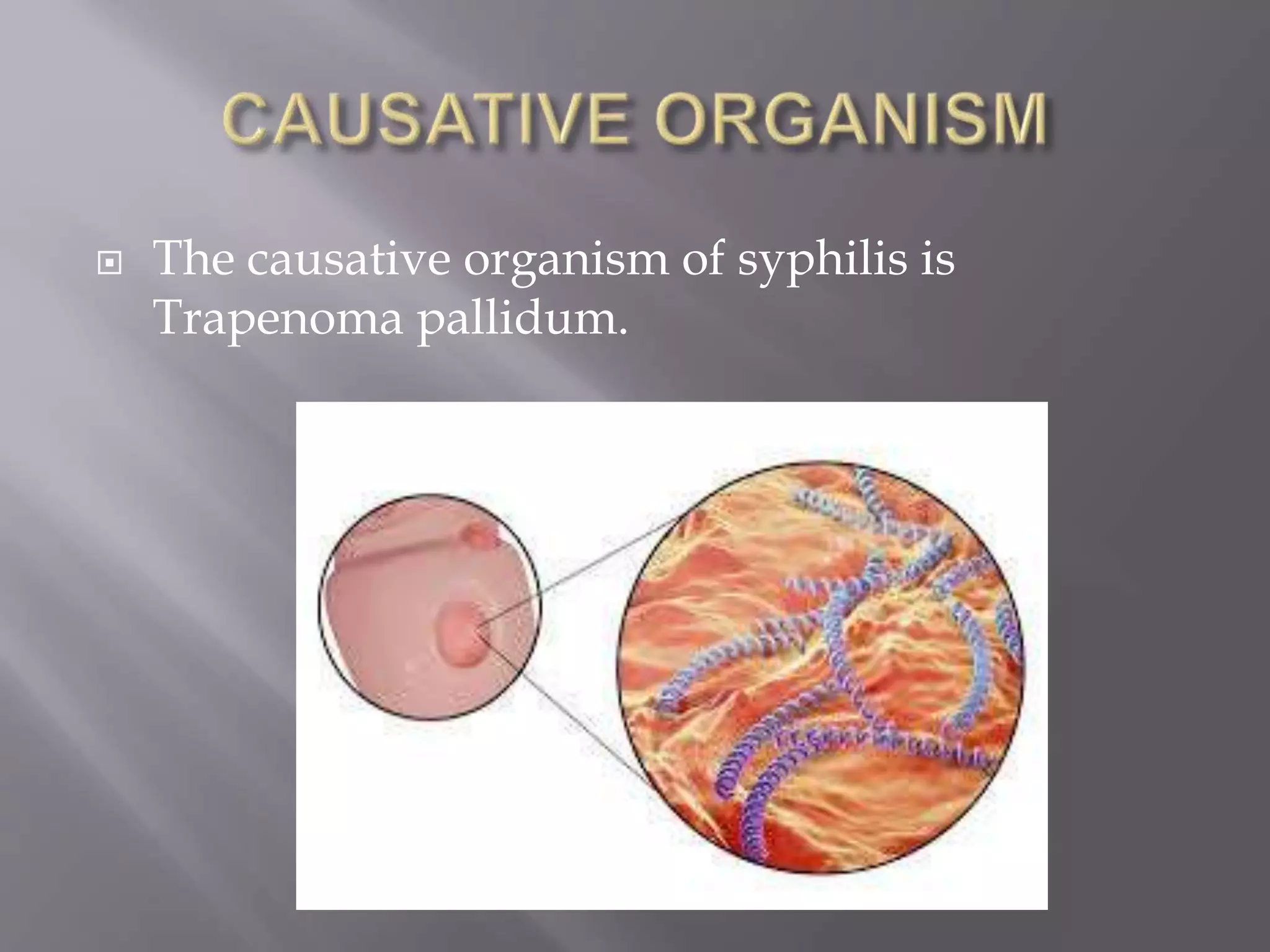 $$ SYPHILIS $$ | PPT