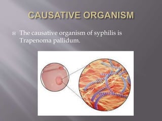 $$ SYPHILIS $$ | PPT