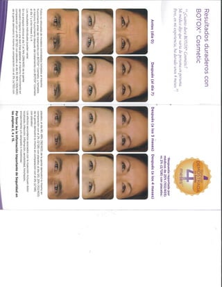 Info on Botox in Spanish | PDF