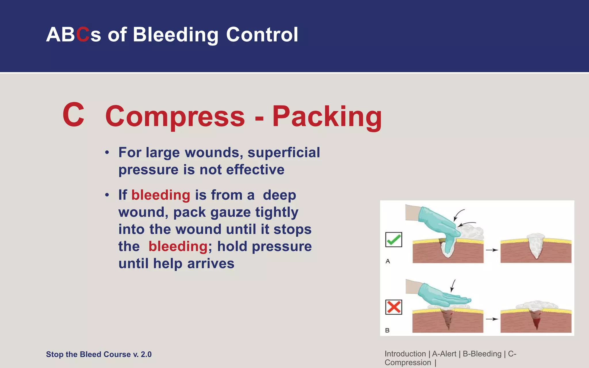 lay-public-stop-the-bleed-presentation-ppt.pptx