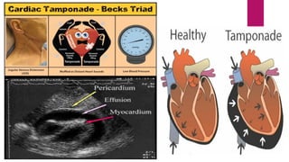 Layers Of Cardiac Wall.pdf | Heart and Cardiovascular Diseases ...