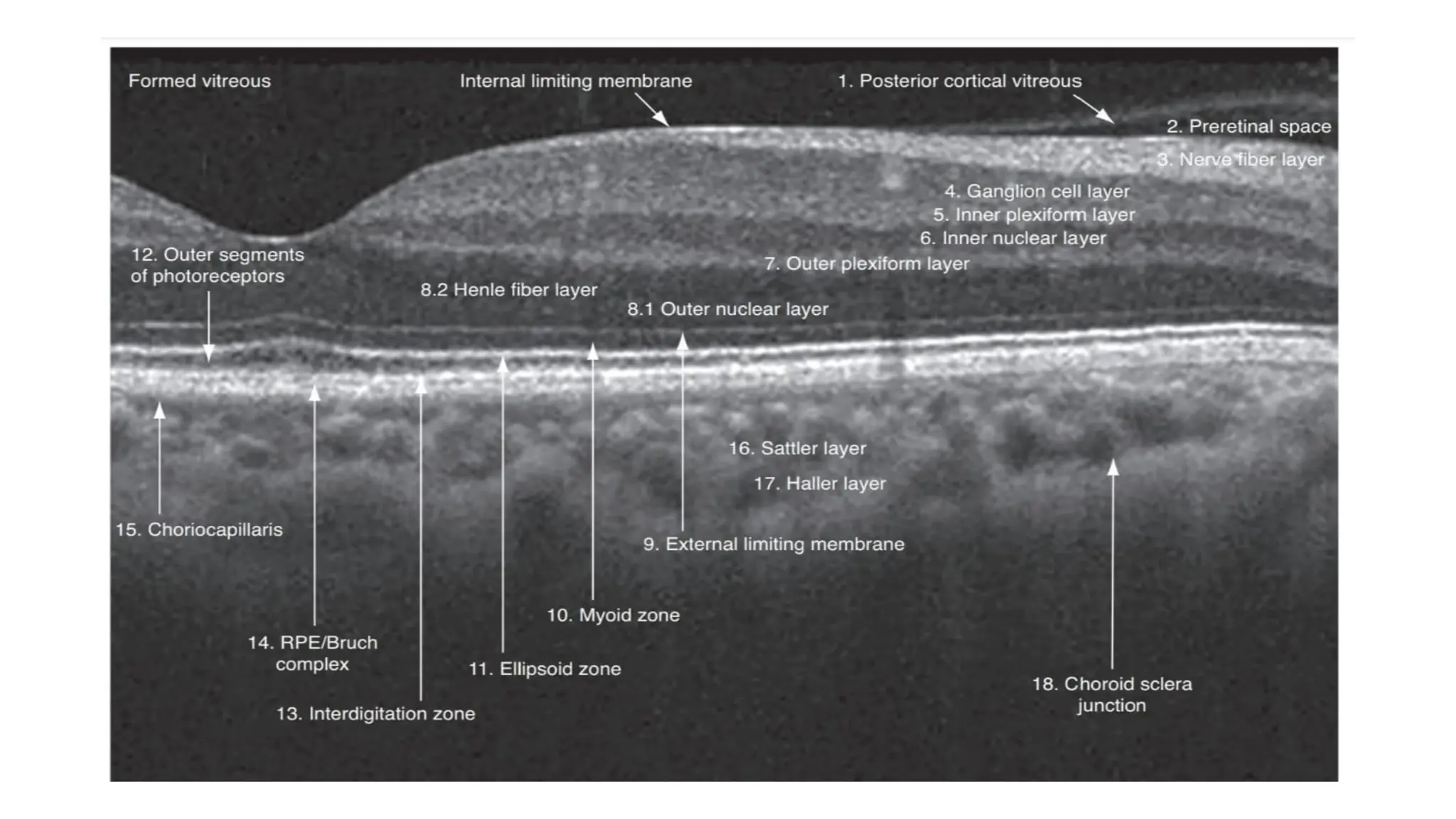 Layers Of Retina Over Oct And Histology Pptx