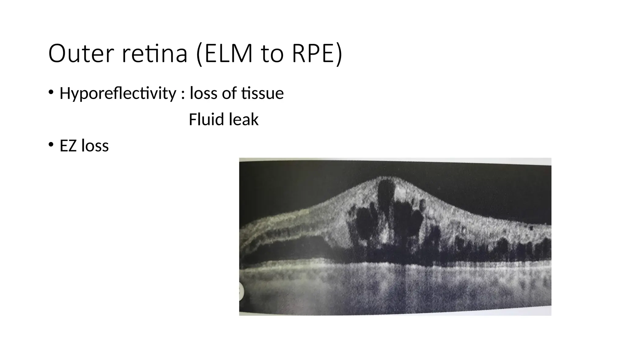 Layers of retina over OCT and histology.pptx