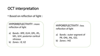 Layers of retina over OCT and histology.pptx