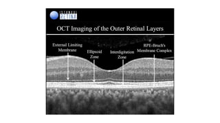 Layers of retina over OCT and histology.pptx