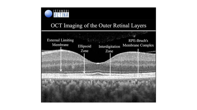 Layers of retina over OCT and histology.pptx