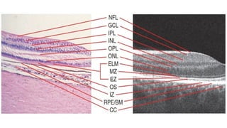 Layers of retina over OCT and histology.pptx