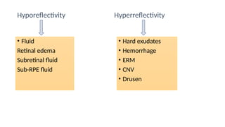 Layers of retina over OCT and histology.pptx