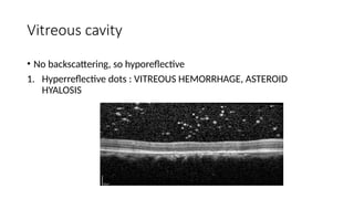 Layers of retina over OCT and histology.pptx