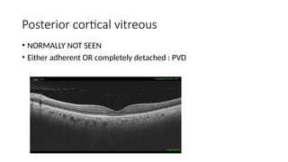 Layers of retina over OCT and histology.pptx