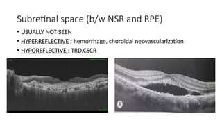 Layers of retina over OCT and histology.pptx