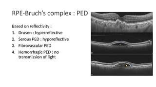 Layers of retina over OCT and histology.pptx