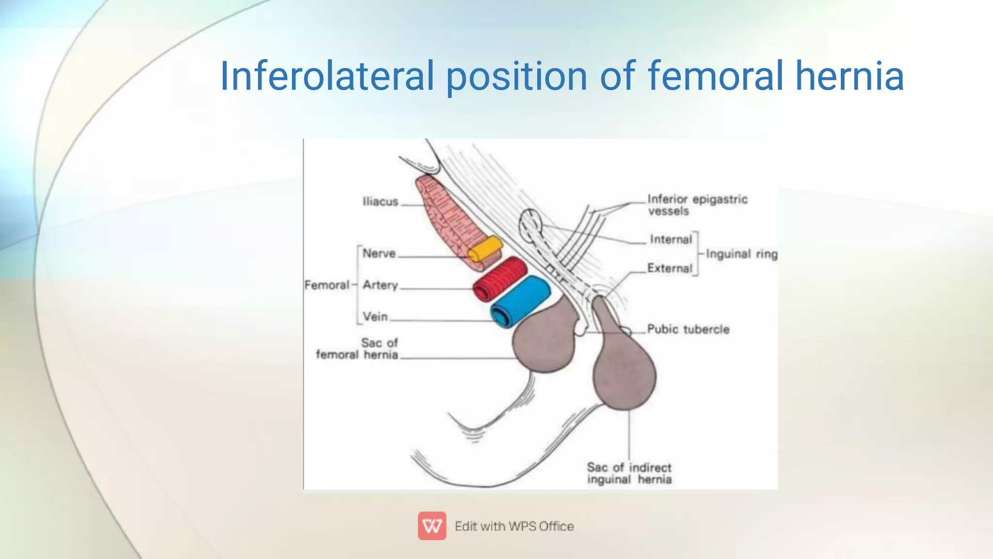 FEMORAL_SHEATH_AND_FEMORAL_HERNIA(2).pdf