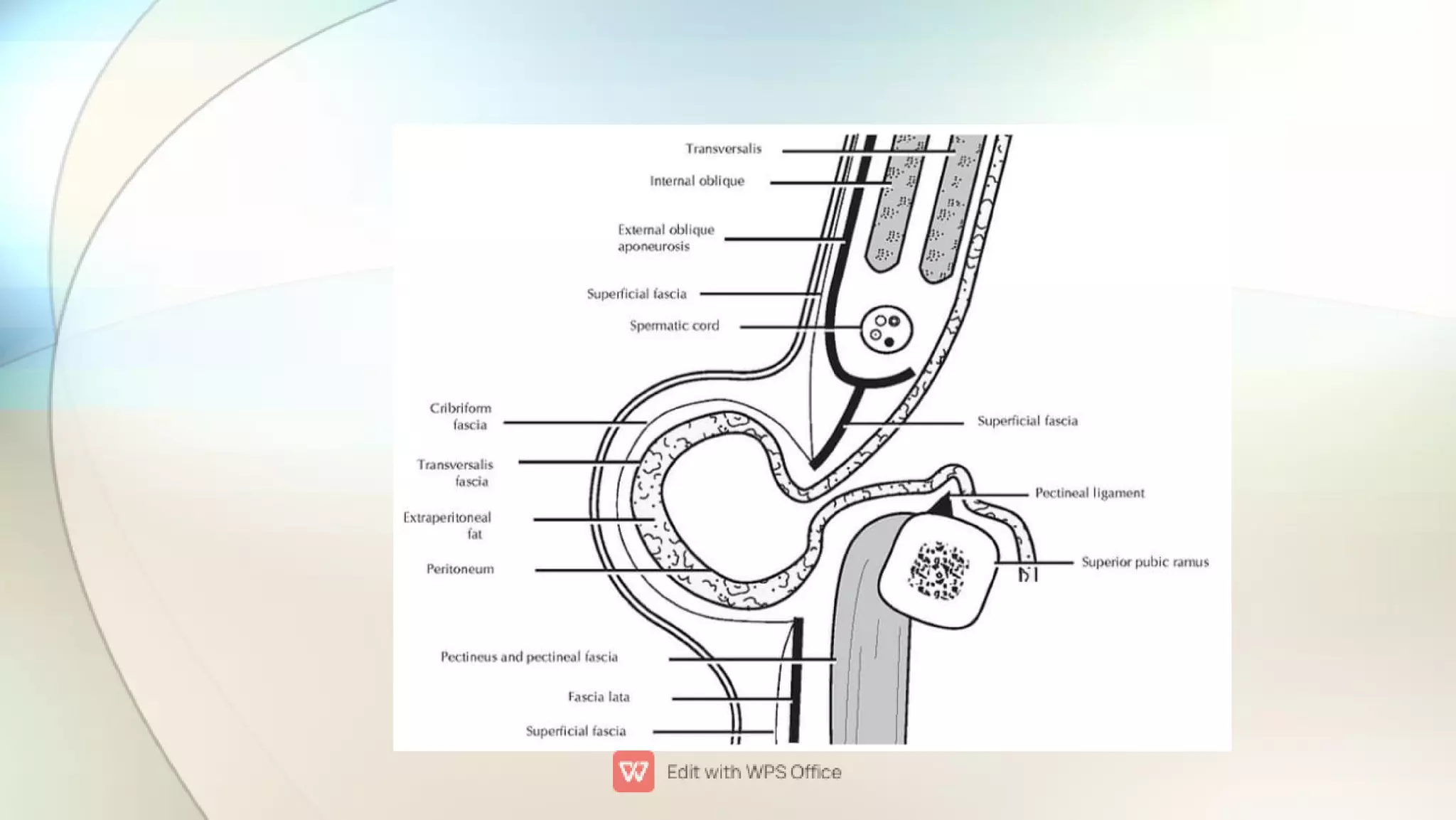 FEMORAL_SHEATH_AND_FEMORAL_HERNIA(2).pdf