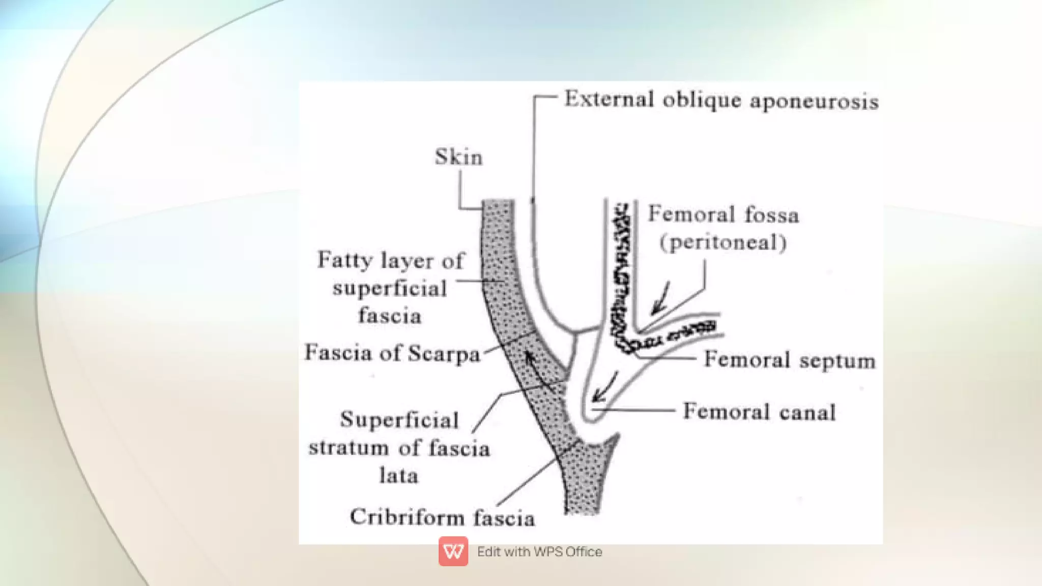 FEMORAL_SHEATH_AND_FEMORAL_HERNIA(2).pdf