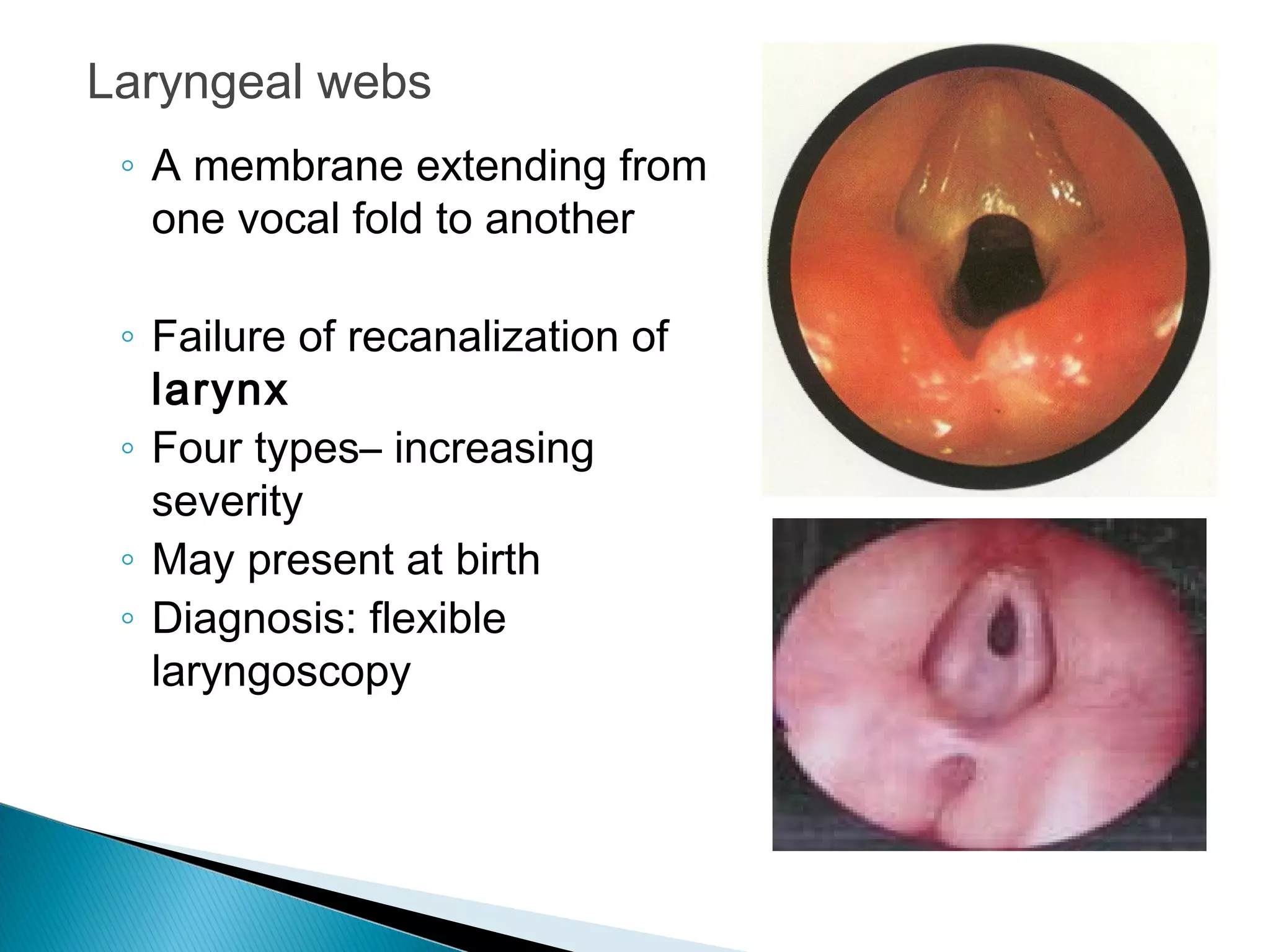 Layrngeal pathologiess | PPT