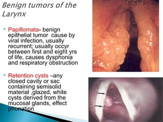 Layrngeal pathologiess | PPT