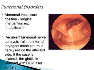 Layrngeal pathologiess | PPT