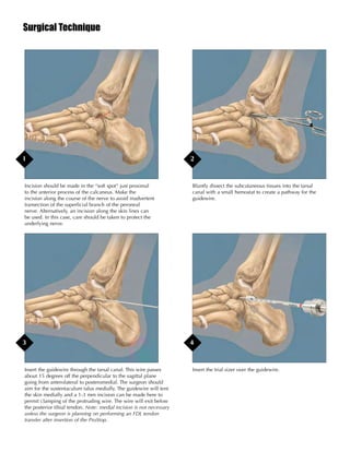 Lb0431 b prostop | PDF