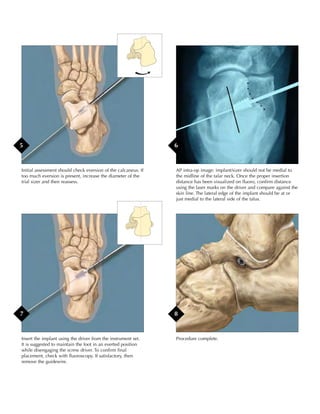 Lb0431 b prostop | PDF