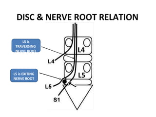 Prolapsed intervertebral disc | PPTX