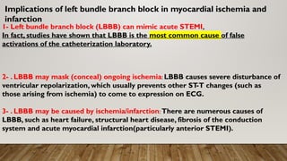 DOSE NEW LBBB MEANS STEMI(paelstine hospital ).pptx