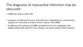 Lbbb in mi | PPT
