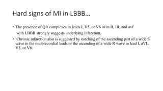 Lbbb in mi | PPT