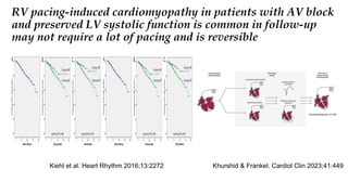 Conduction system pacing (with emphasis on left bundle branch pacing ...