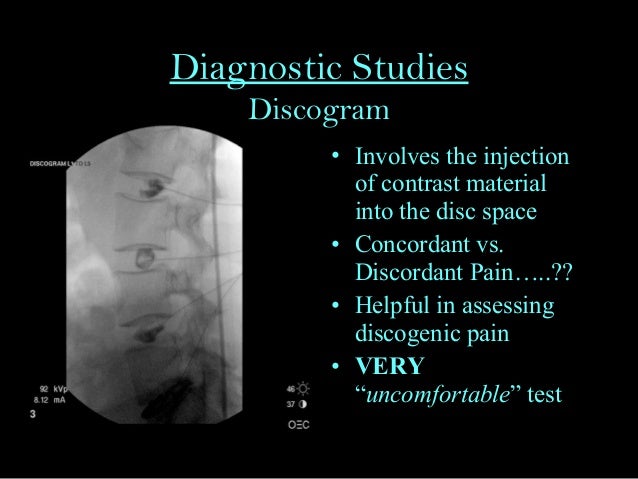 Low Back Pain: Diagnosis to Treatment!