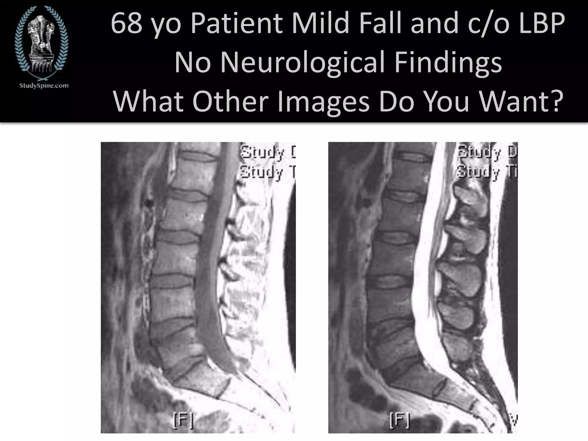 68 year old patient had a mild fall and complains of lower back pain | PPT