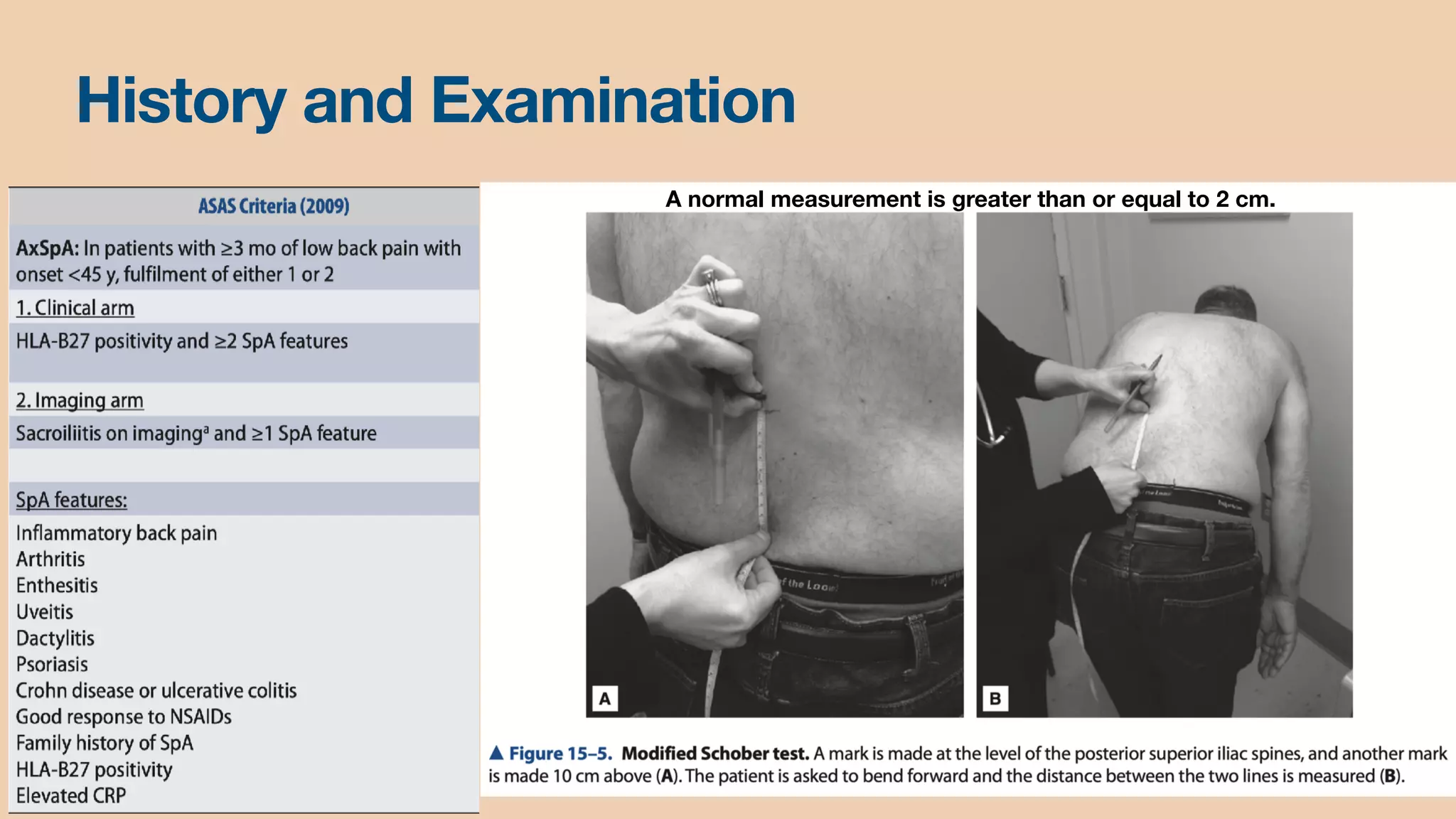 Low Back Pain.pdf | Physical Therapy | Wellness