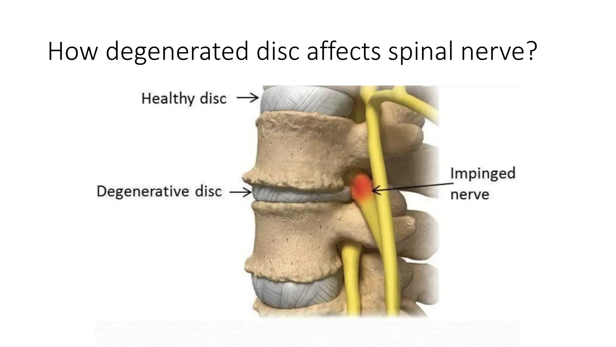Low back pain differential diagnosis and treatment | PPTX