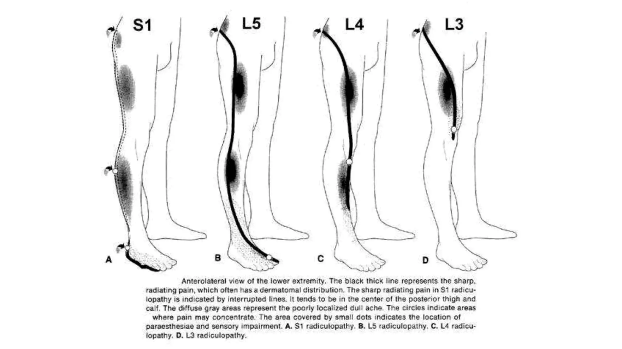 Low back pain differential diagnosis and treatment | PPTX