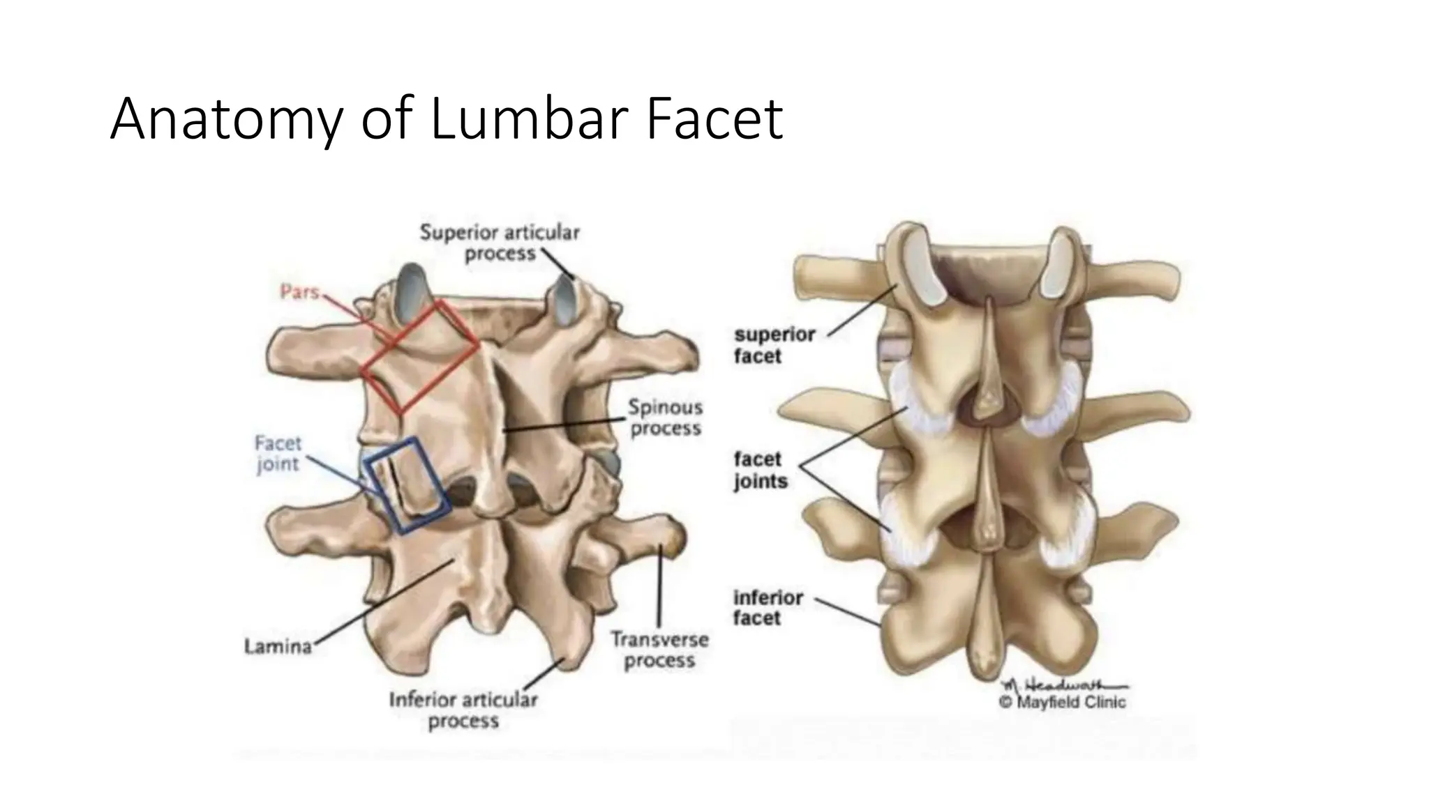 Low back pain differential diagnosis and treatment | PPTX